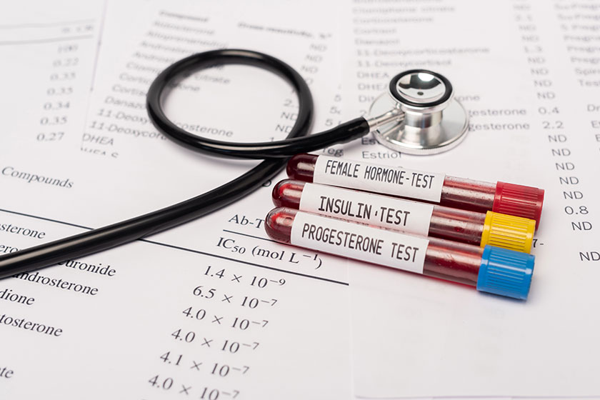 Understanding How Your Hormones Change As You Grow Older – Morada ...