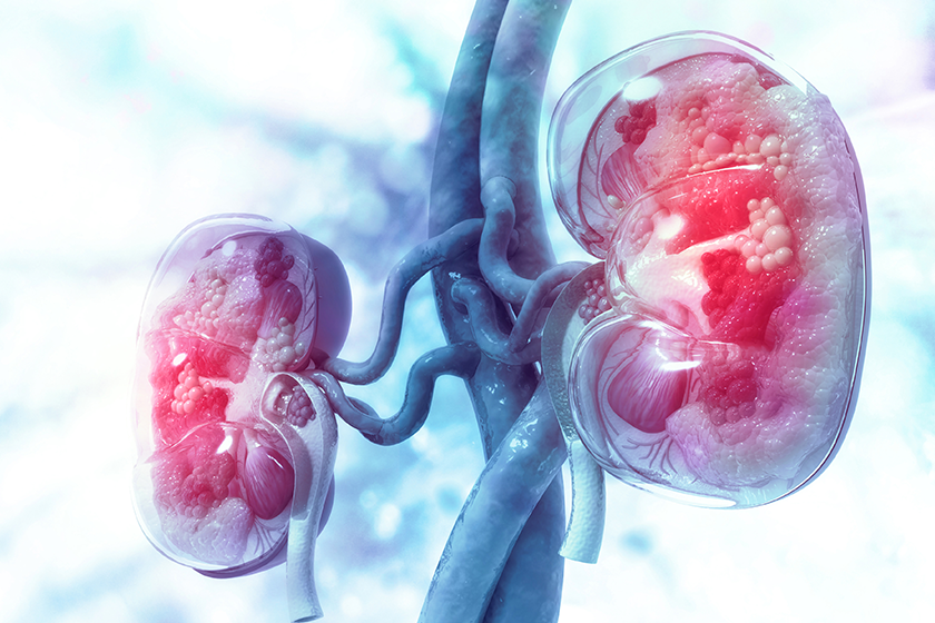 How Kidney Disease Is Diagnosed In Seniors – Morada Senior Living